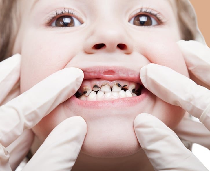 Common Dental Issues and How Pediatric Dentists Help