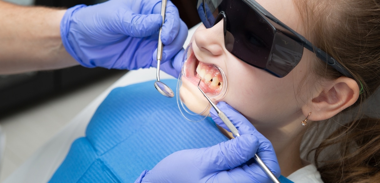 Understanding When Kids Need Root Canal